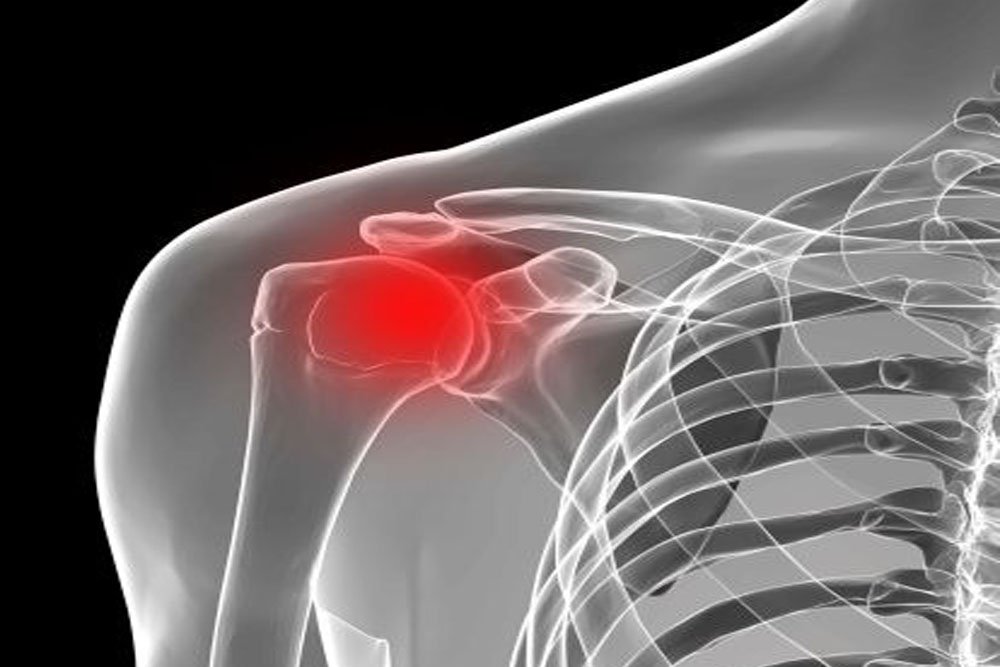 Types of Work-Related Injuries in Orthopedics - Dr. Vatsal Khetan ...